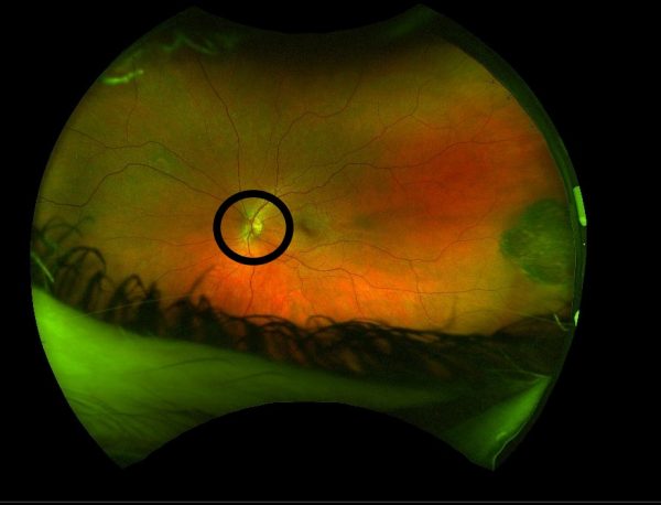 Eye Examinations - Morgan Optometry
